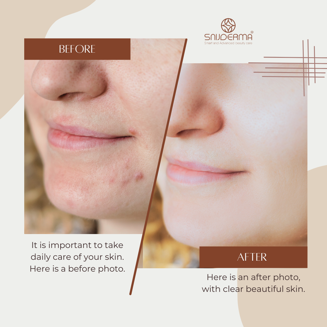 GLOW ESSENCE CTM KIT